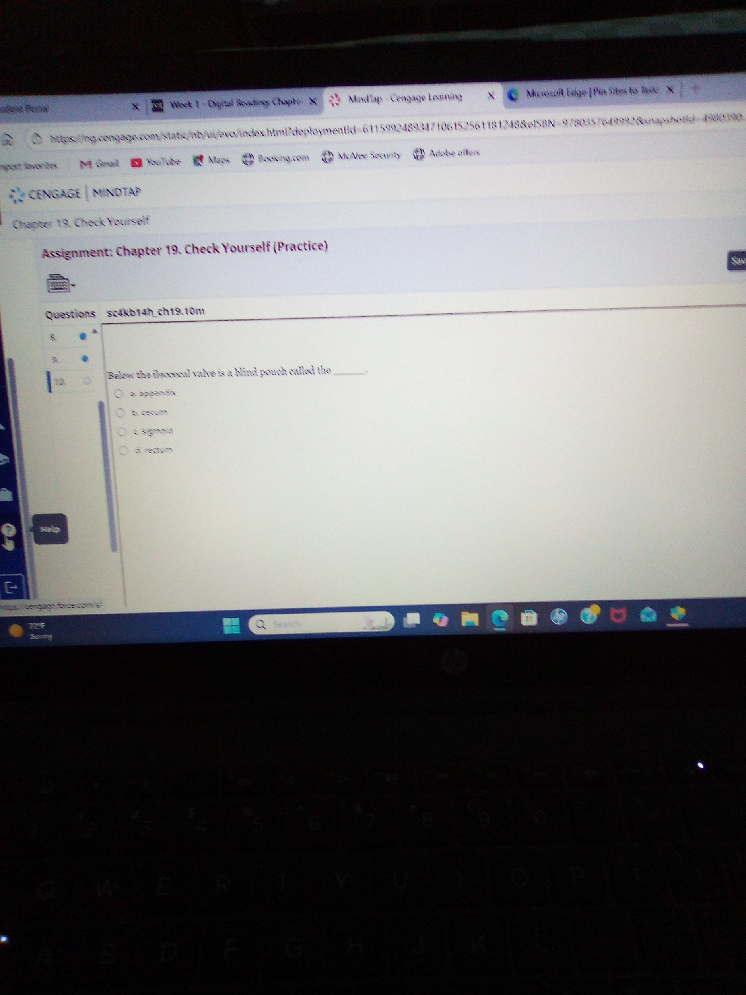 Below the ileocecal valve is a blind pouch | StudyX