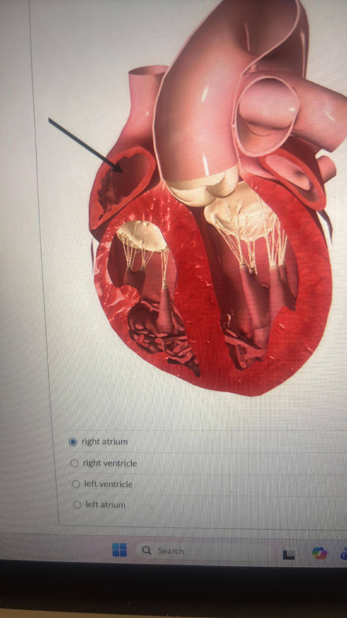 Identify the structure indicated by the | StudyX