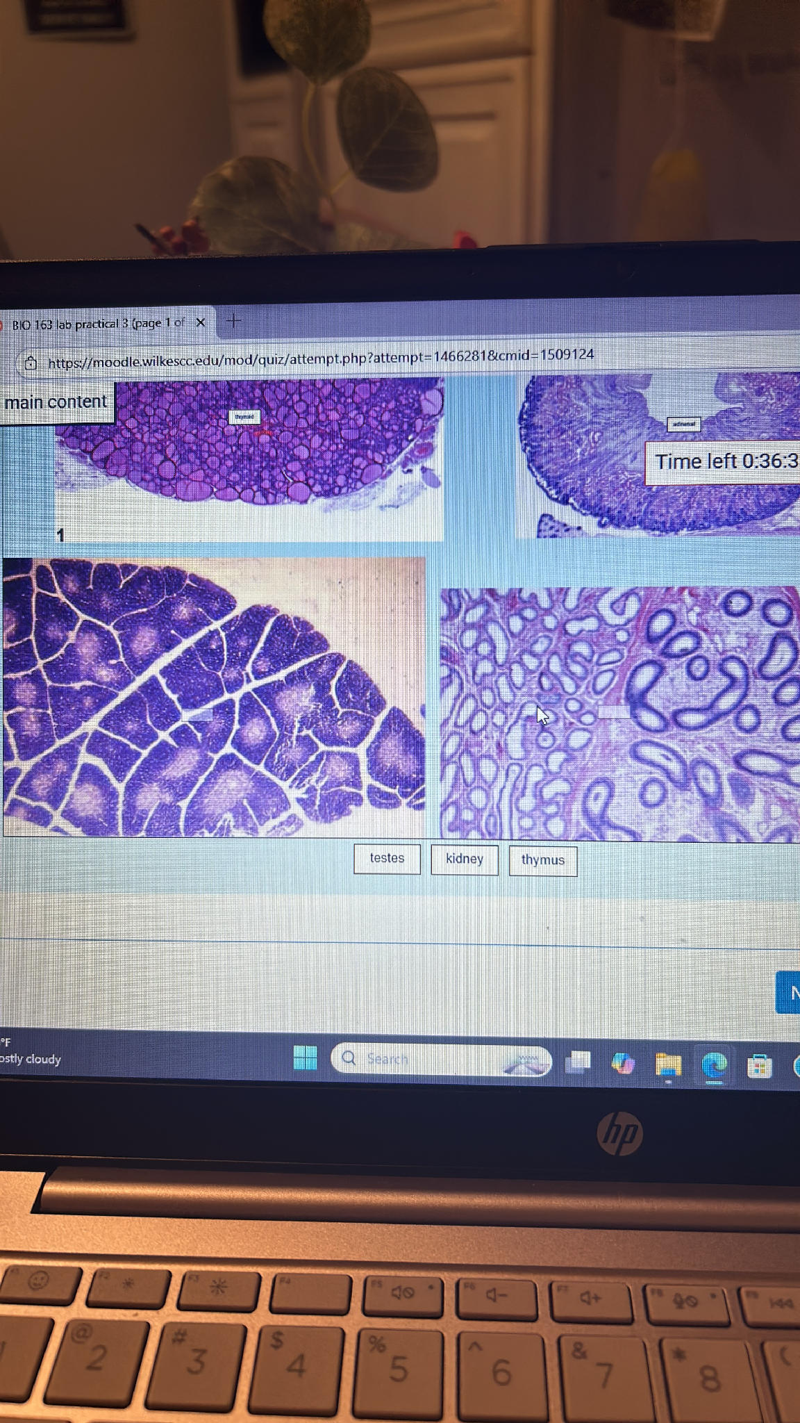 Identify the structure/organ shown in the | StudyX