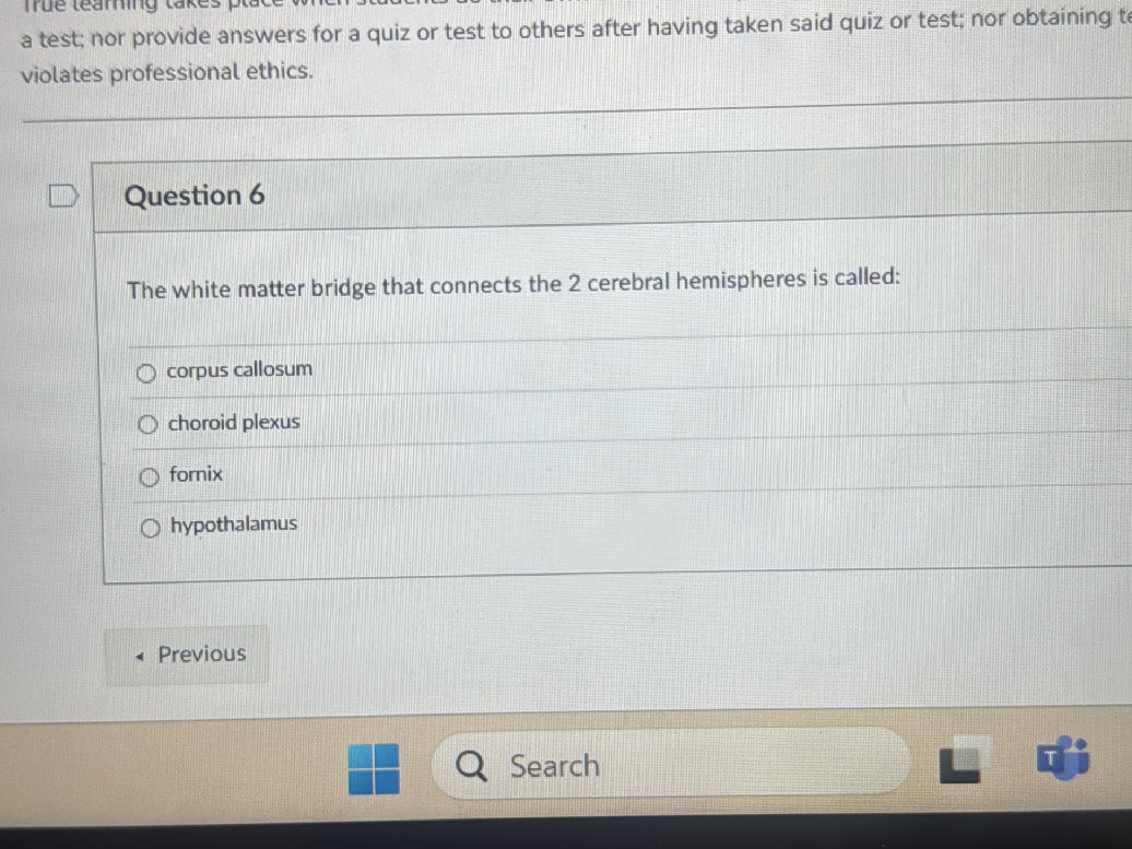 The white matter bridge that connects the 2 | StudyX