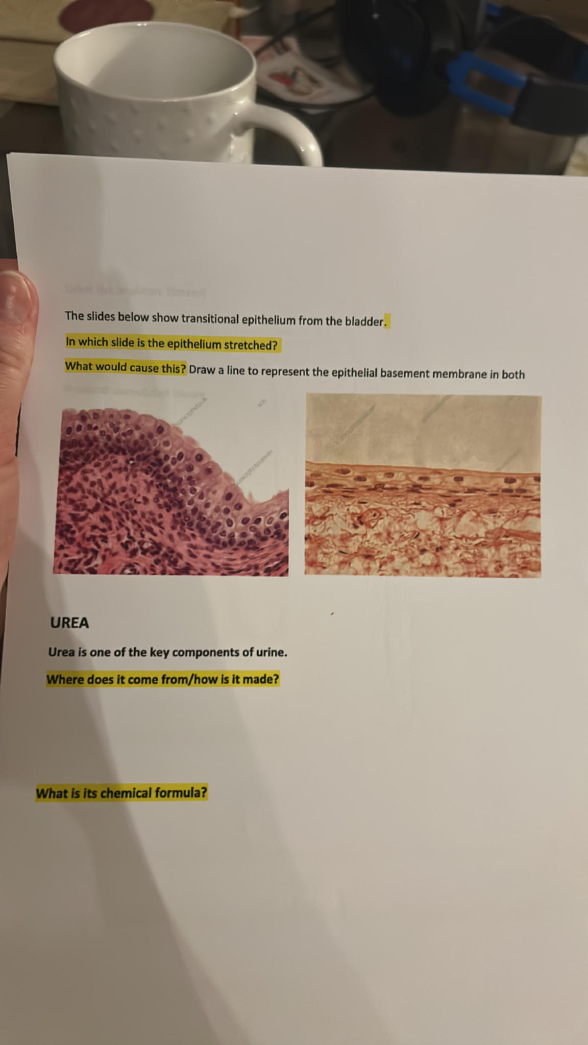 The slides below show transitional | StudyX