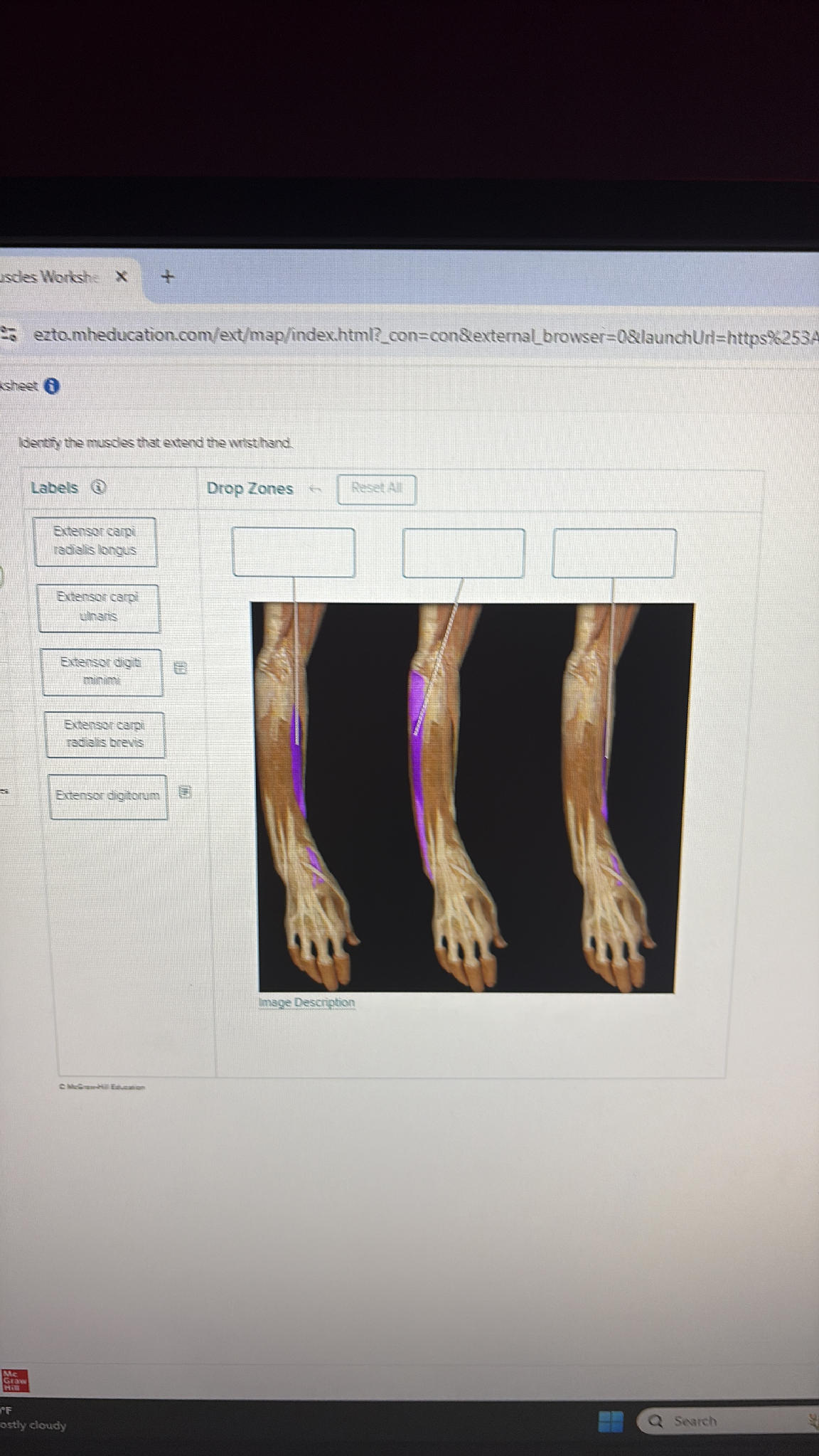 Identify the muscles that extend the | StudyX