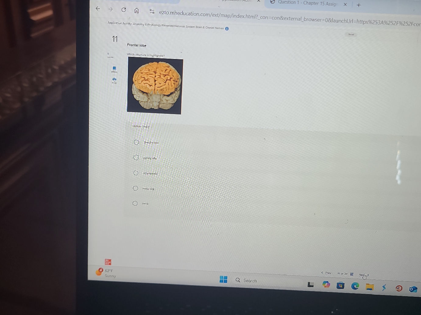 Frontal lobe Which structure is | StudyX