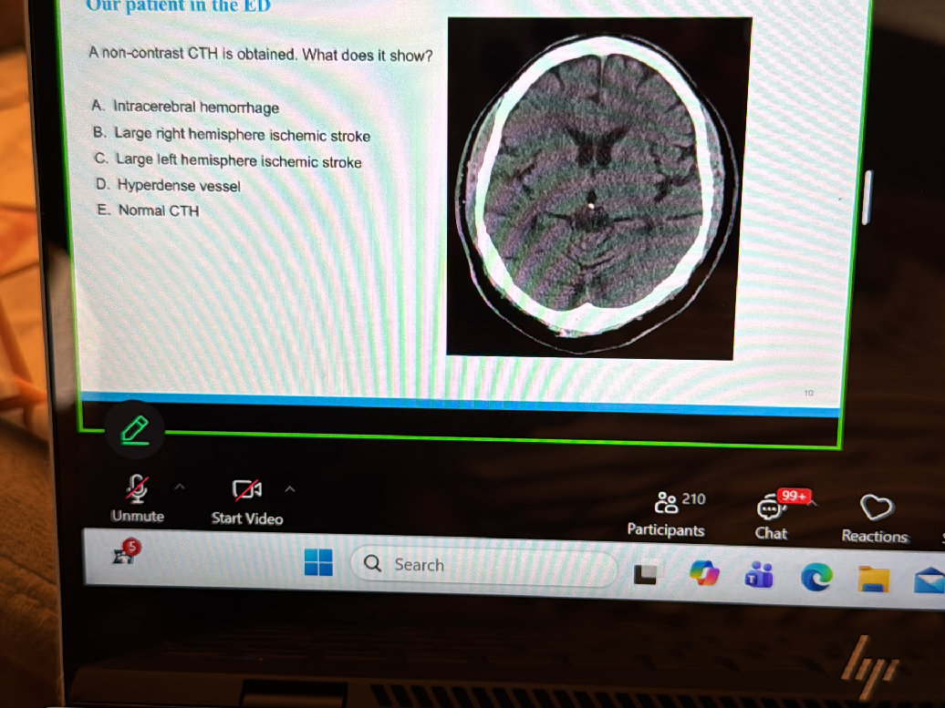 Our patient in the ED A non-contrast CTH is | StudyX