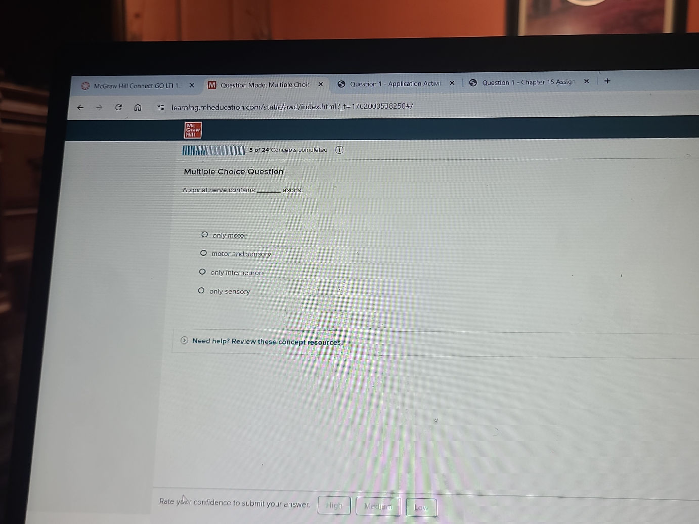 Multiple Choice Question A spinal nerve | StudyX