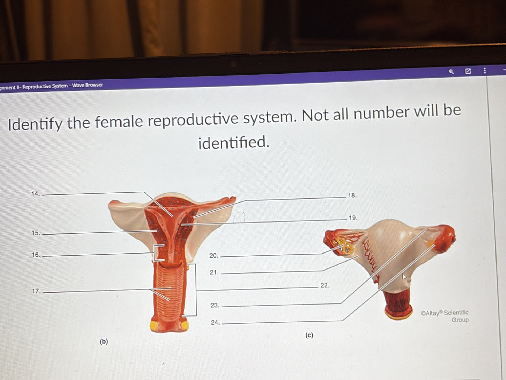 Identify the female reproductive system. Not | StudyX