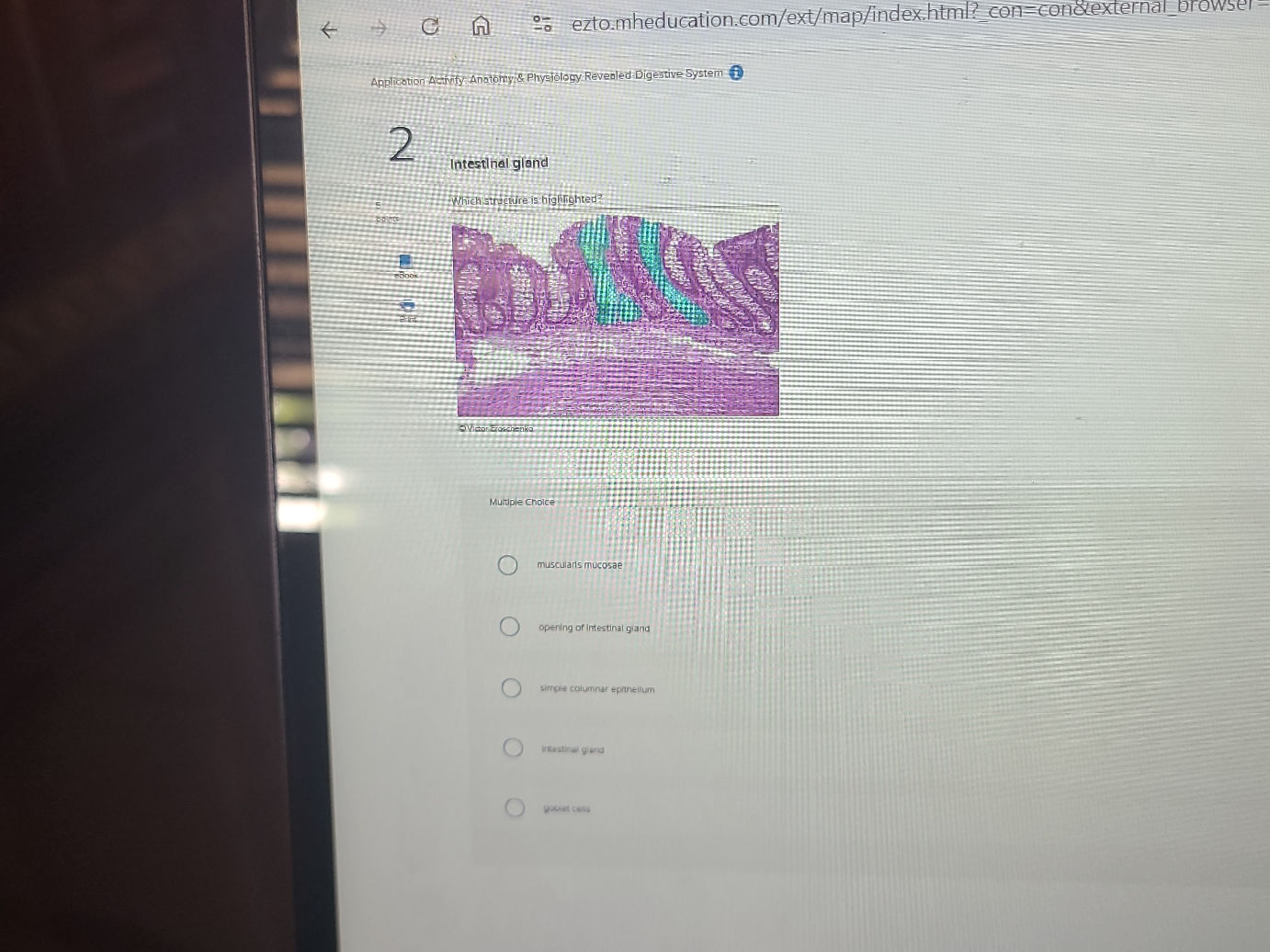 Intestinal gland Which structure is | StudyX