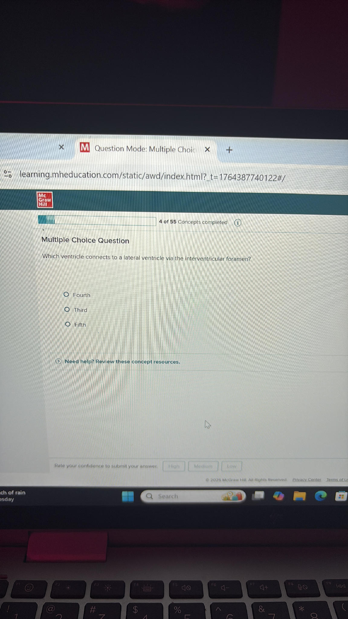 Multiple Choice Question Which ventricle | StudyX