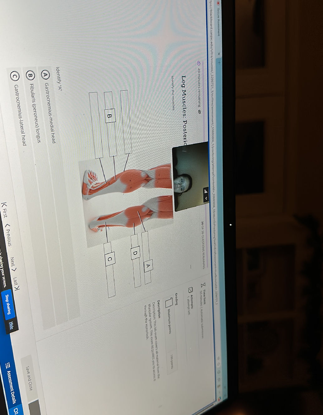 Leg Muscles: Posterior Identify the | StudyX
