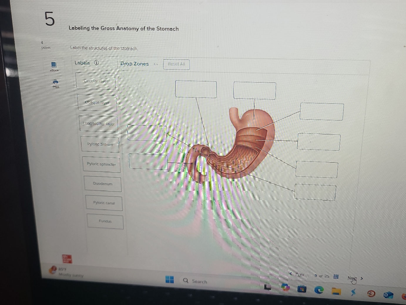 Labeling the Gross Anatomy of the Stomach 4 | StudyX
