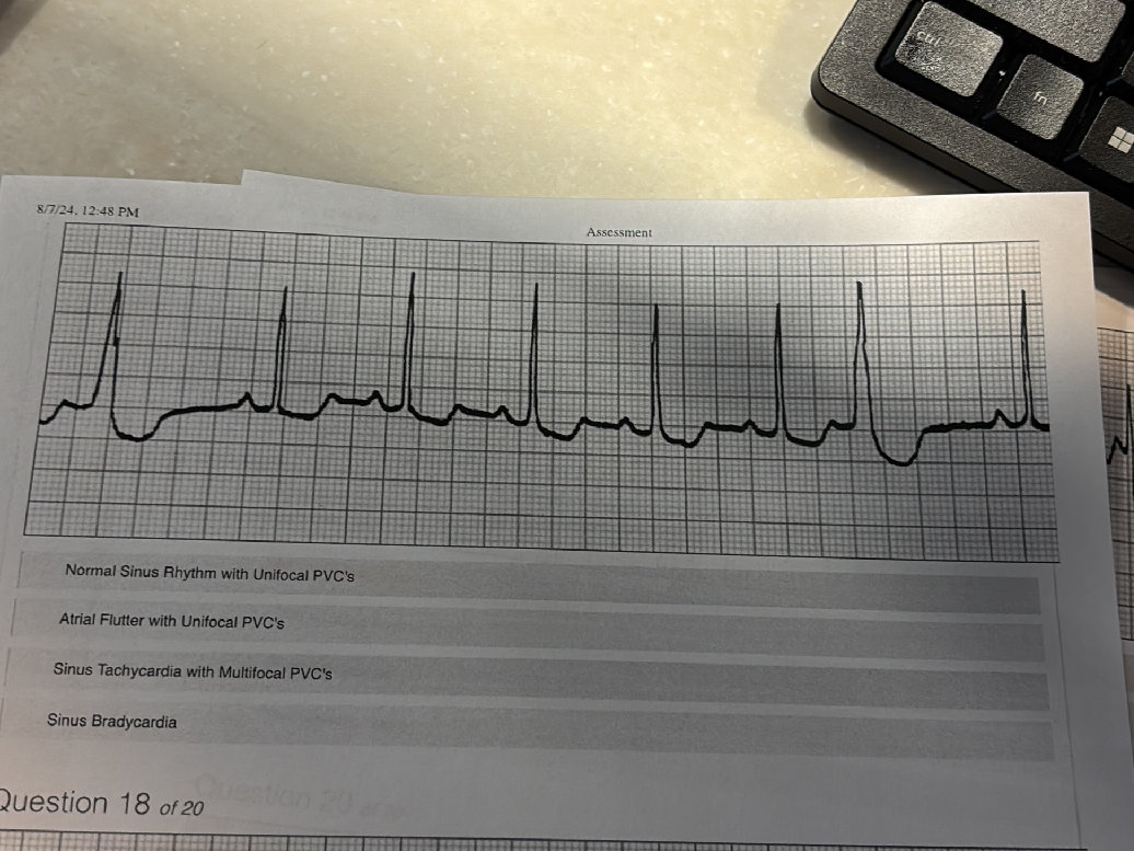 Analyse the provided ECG strip | StudyX