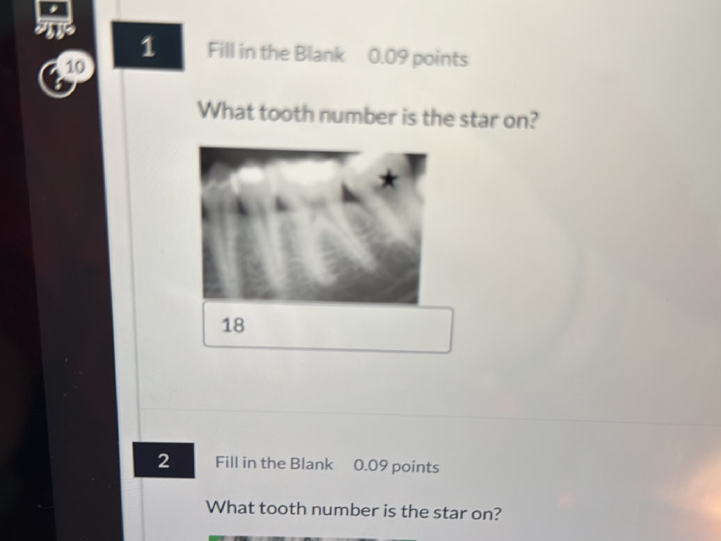Fill in the Blank What tooth number is the | StudyX