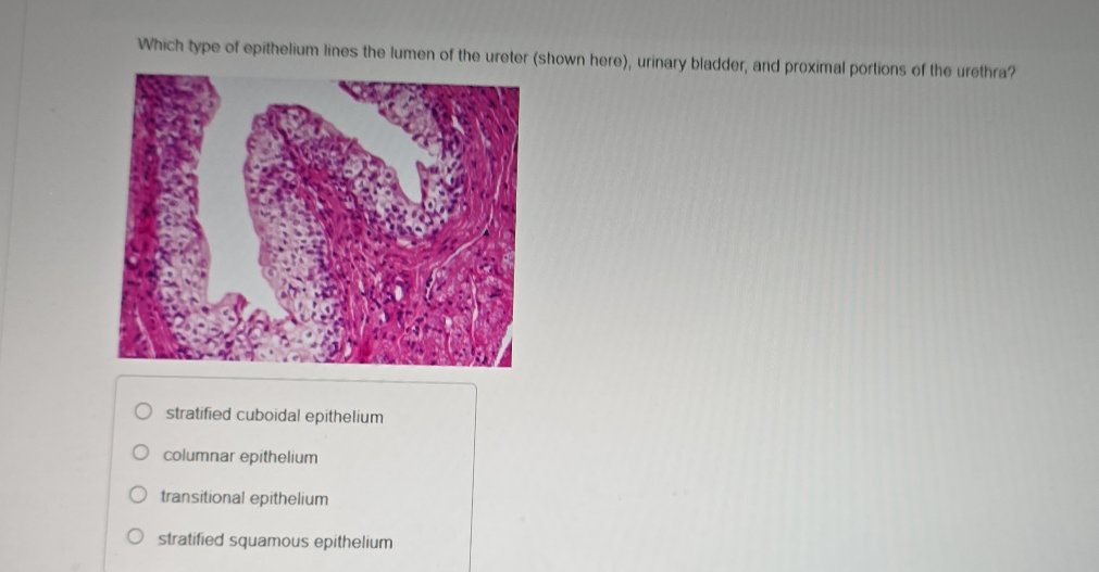 Which type of epithelium lines the lumen of | StudyX