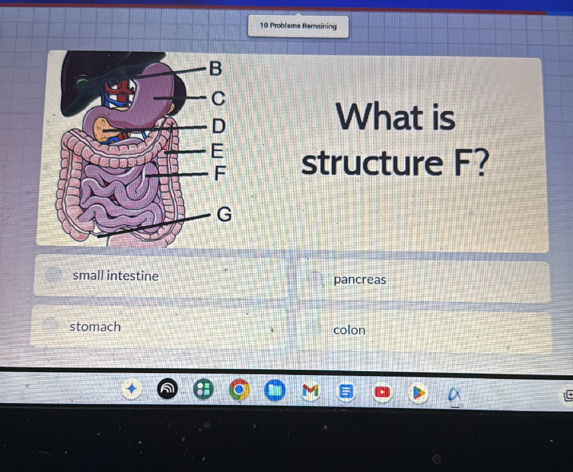 Identify the structure labeled F in the | StudyX