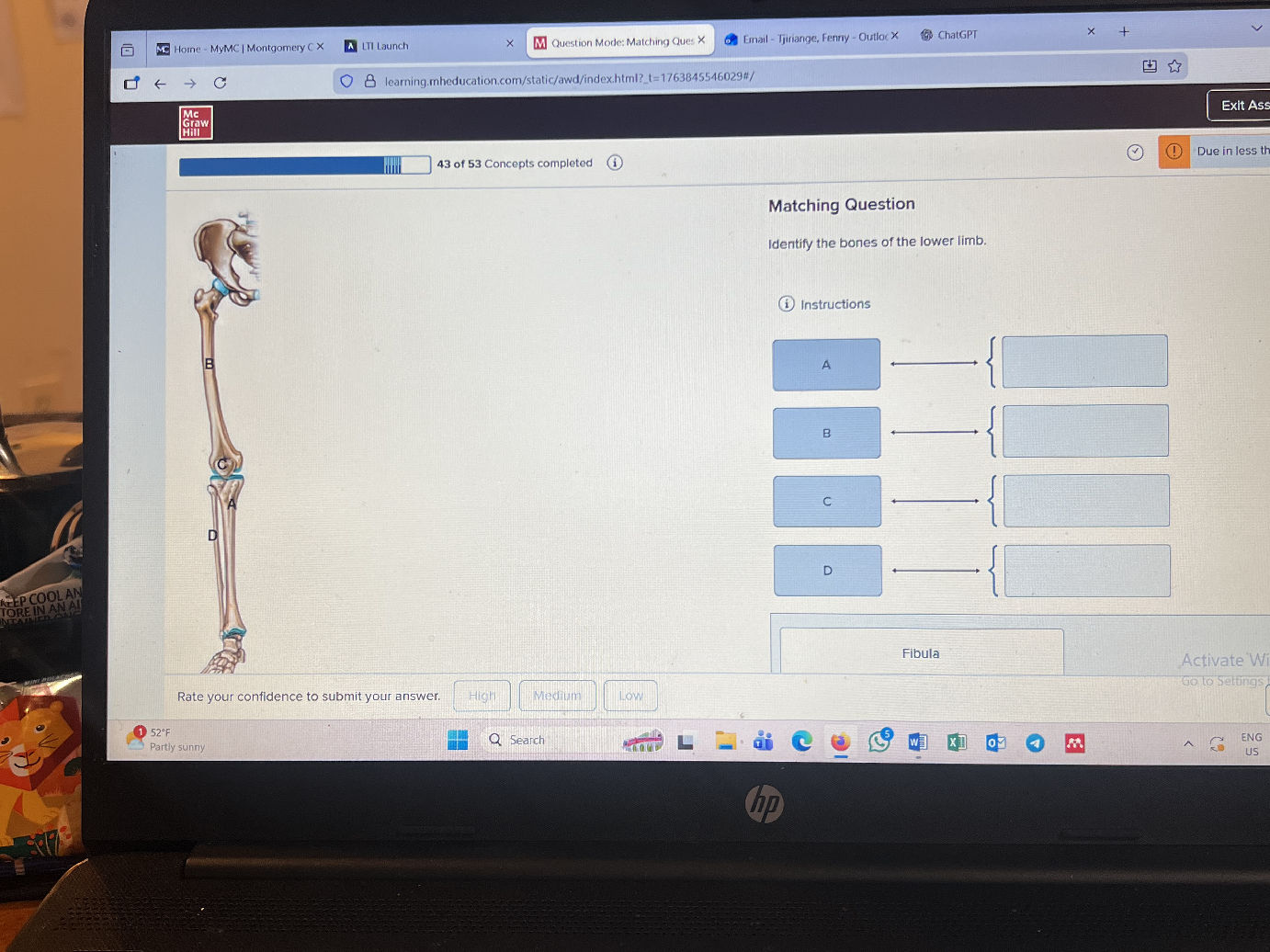 Matching Question Identify the bones of the | StudyX