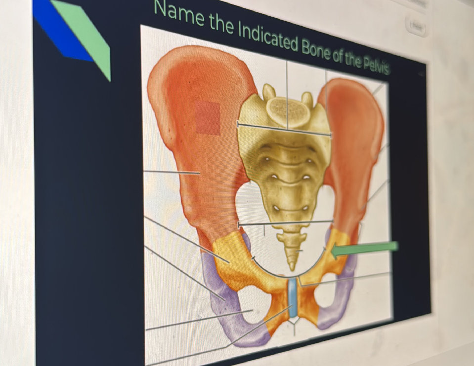 Name the Indicated Bone of the Pelvis. (The | StudyX