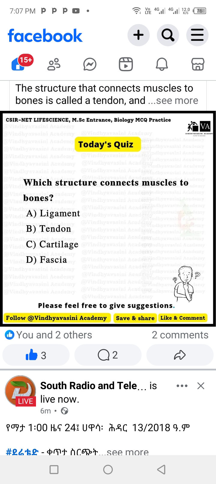 The structure that connects muscles to bones | StudyX