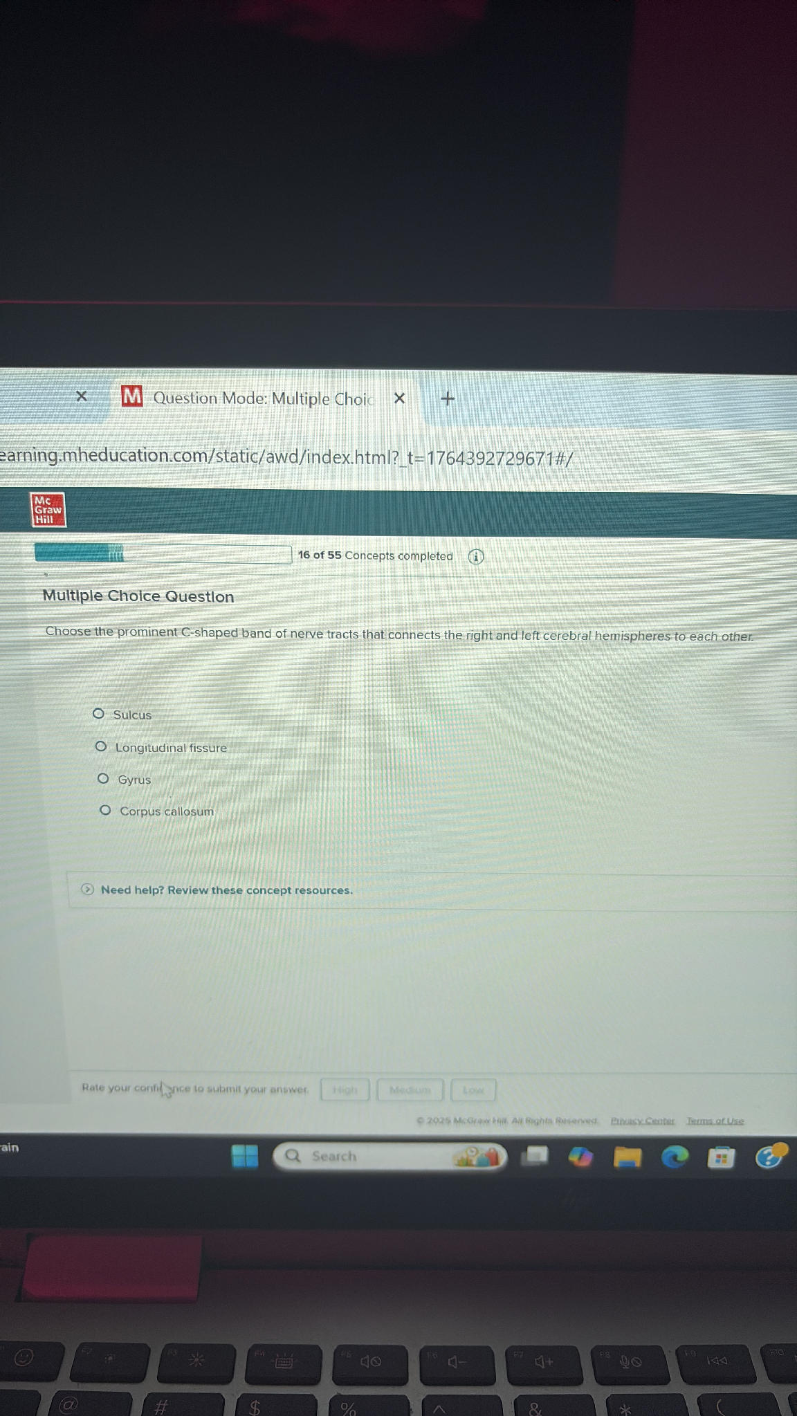 Multiple Choice Question Choose the | StudyX