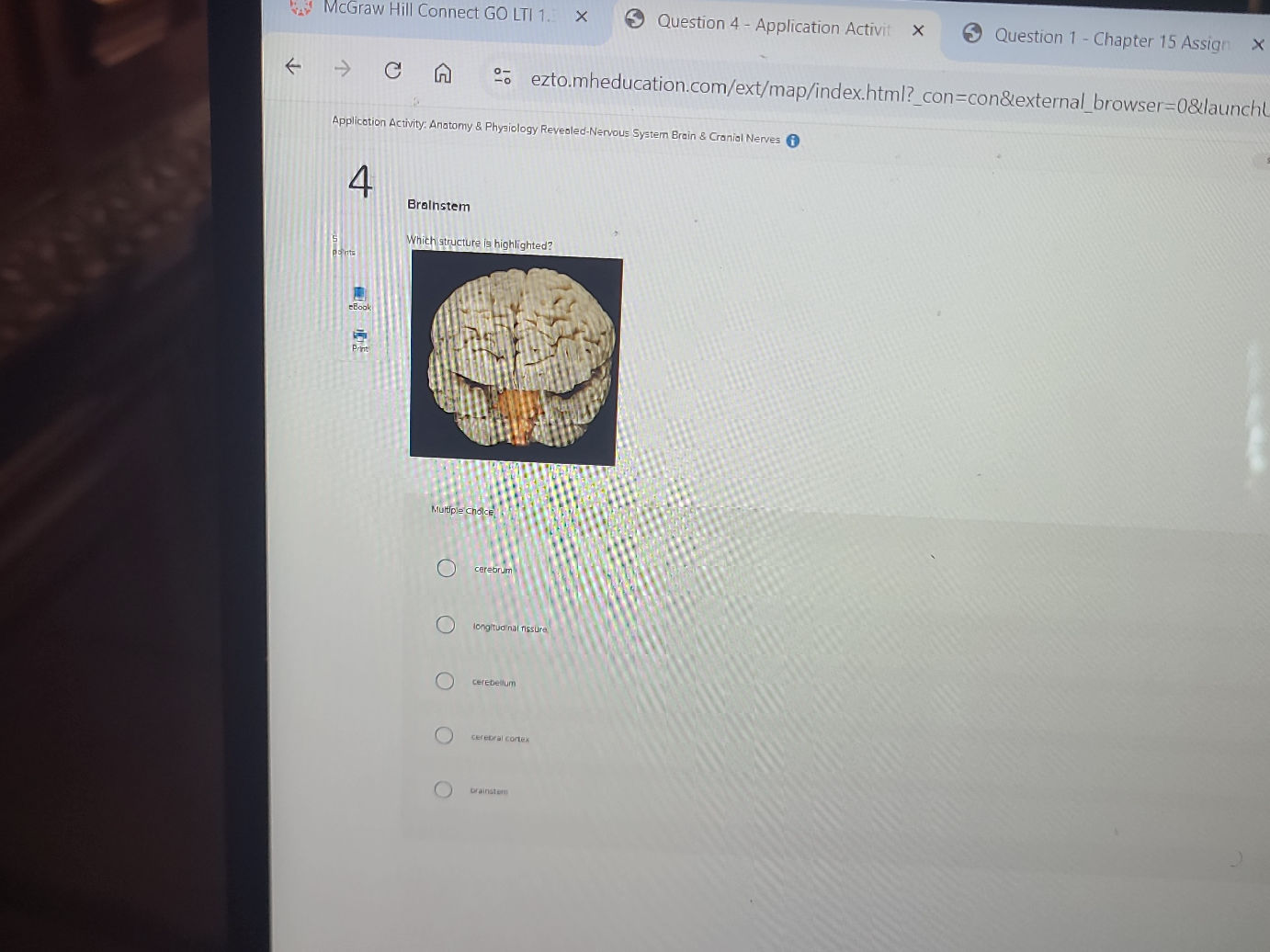 Brainstem Which structure is highlighted? | StudyX