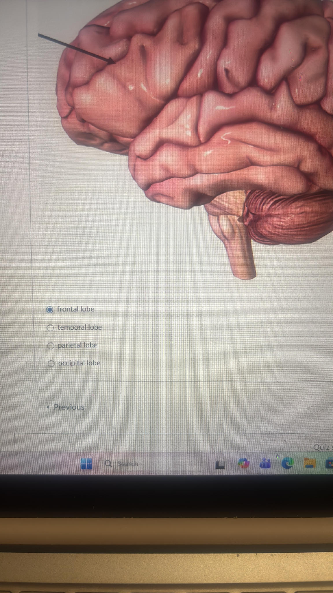 Identify the lobe of the brain indicated by | StudyX