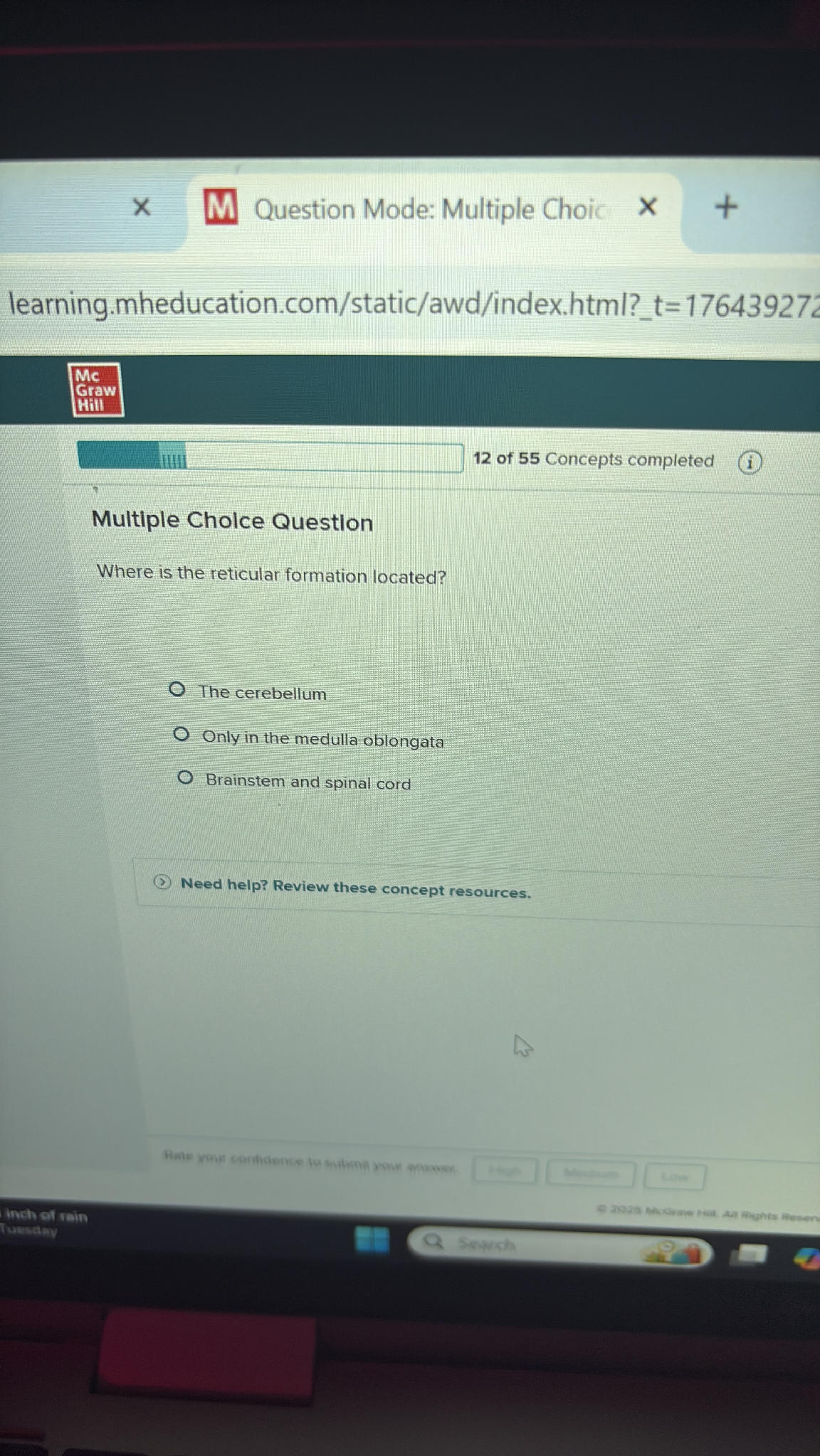 Multiple Choice Question Where is the | StudyX