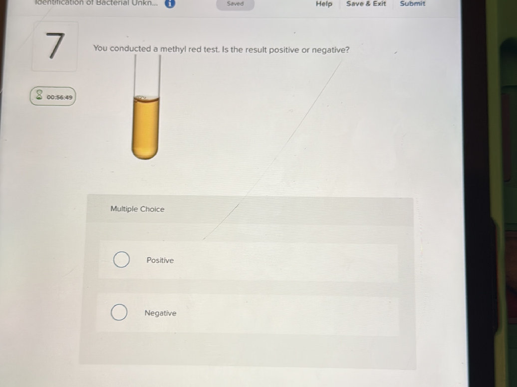 You conducted a methyl red test. Is the | StudyX
