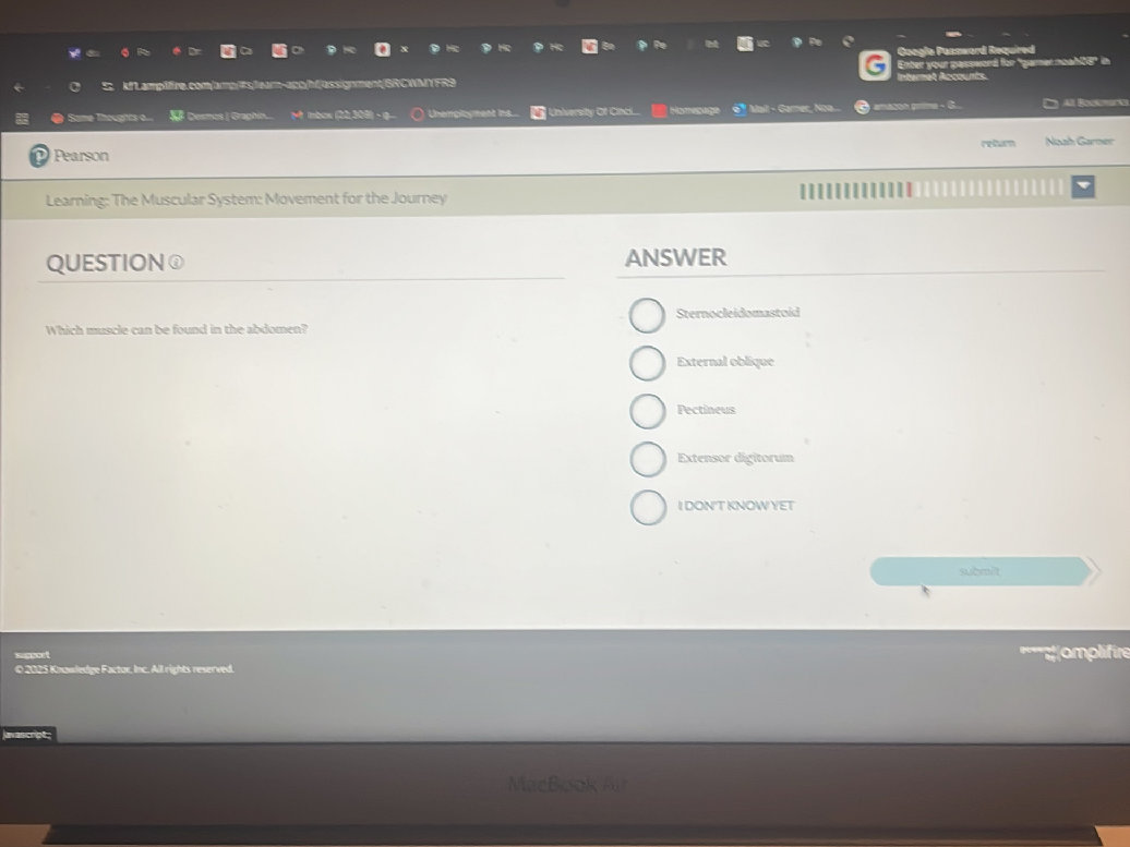 Which muscle can be found in the abdomen? | StudyX