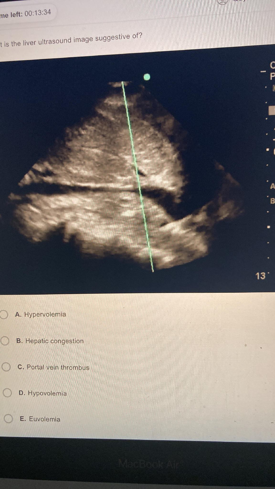 What is the liver ultrasound image | StudyX