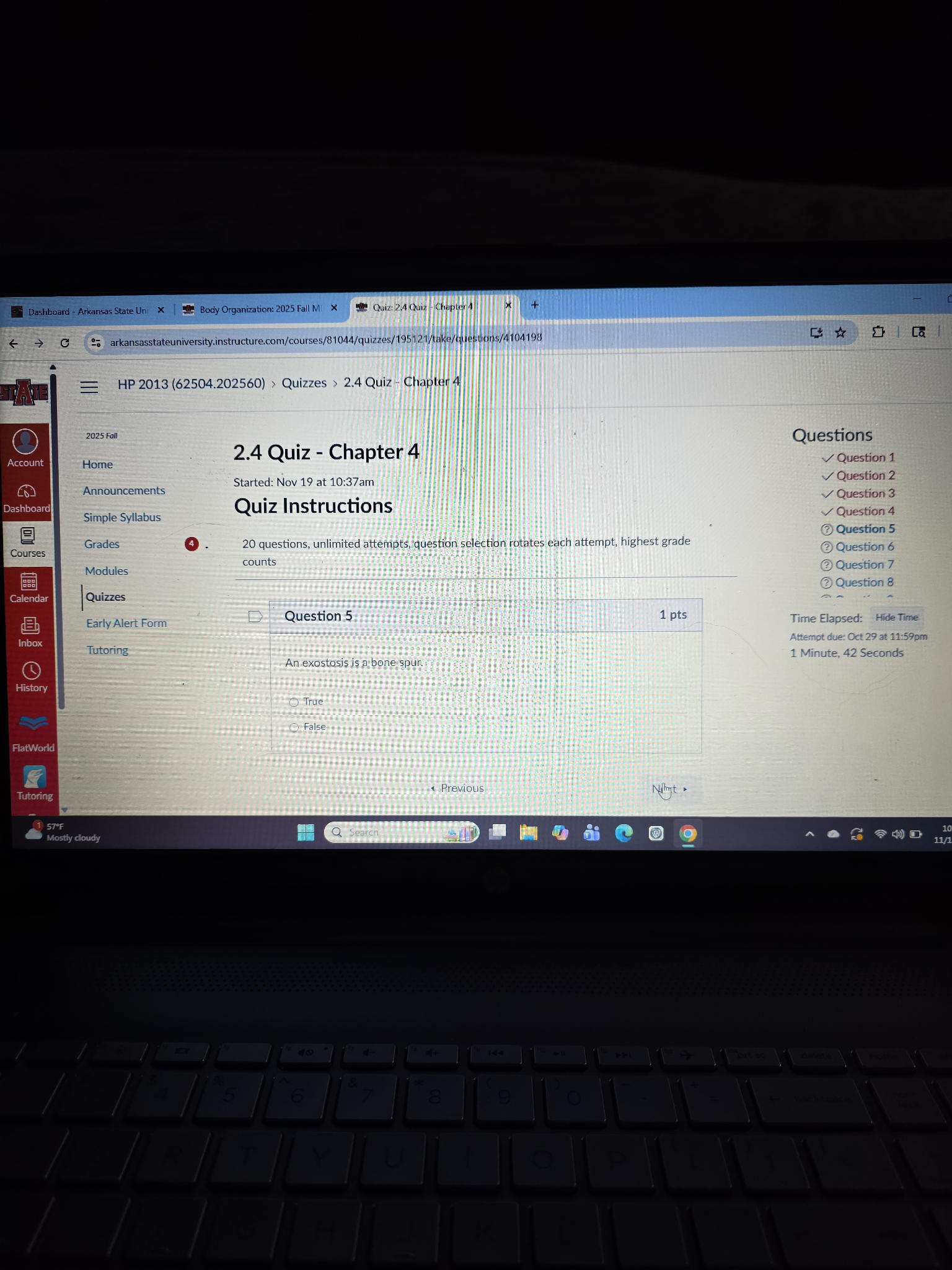 Question 5 1 pts An exostosis is a bone | StudyX