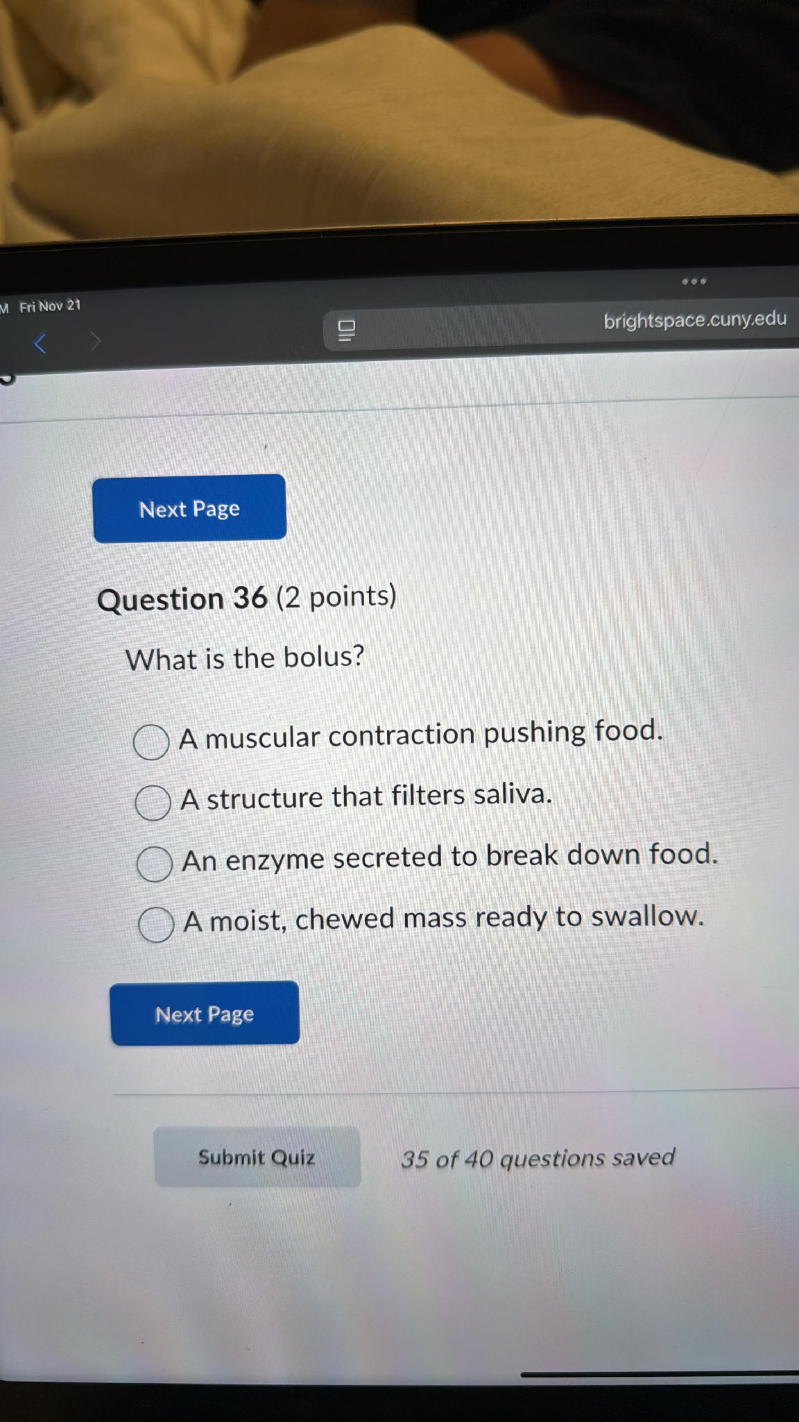 Question 36 (2 points) What is the bolus? A | StudyX