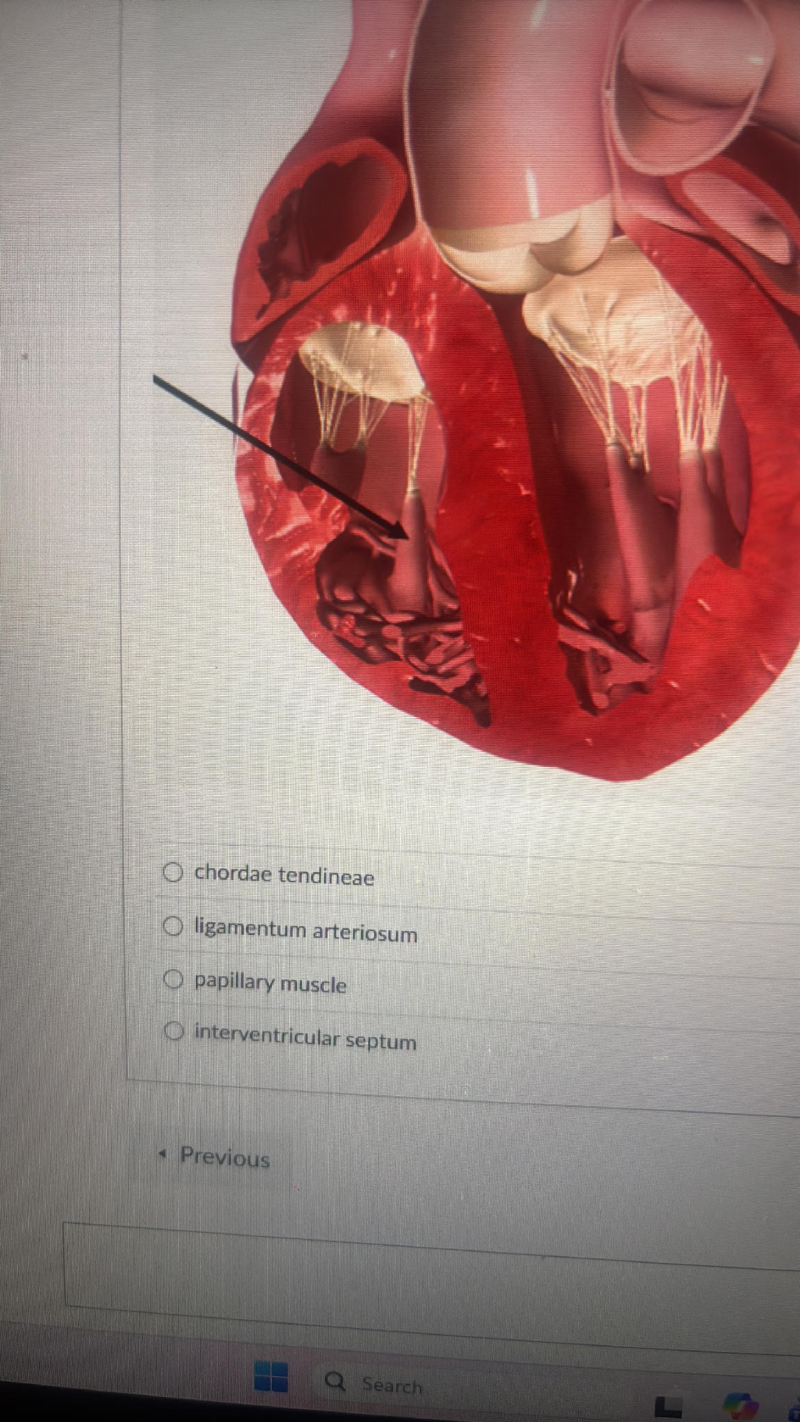 The arrow in the image points to which | StudyX