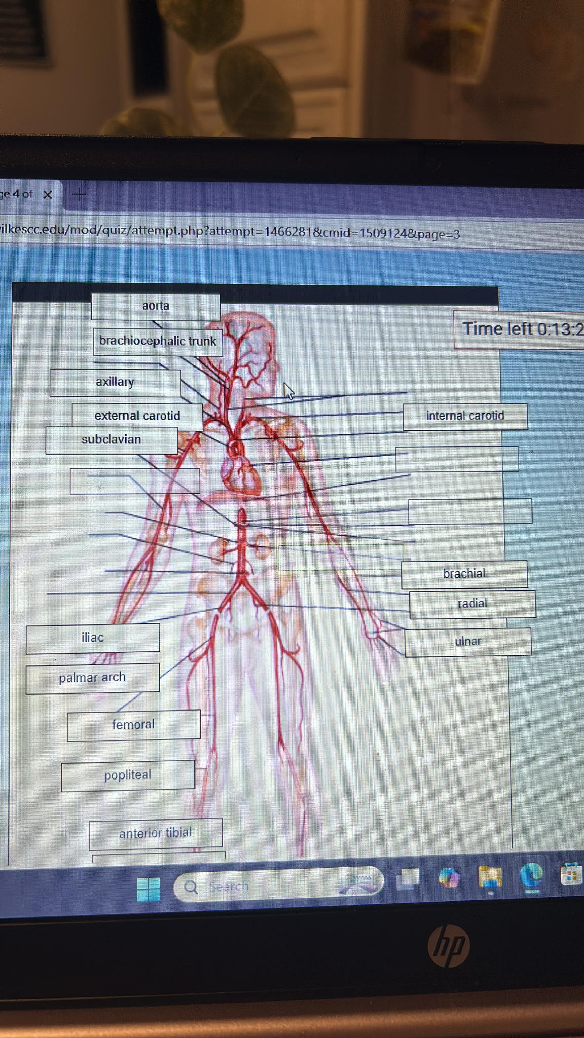 Identify the blood vessels labeled on the | StudyX