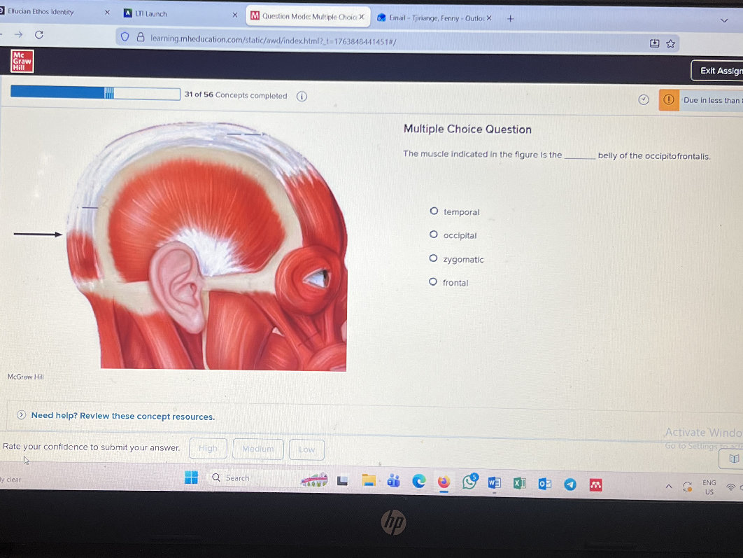 Multiple Choice Question The muscle | StudyX