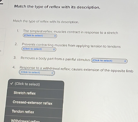 Match the type of reflex with its | StudyX