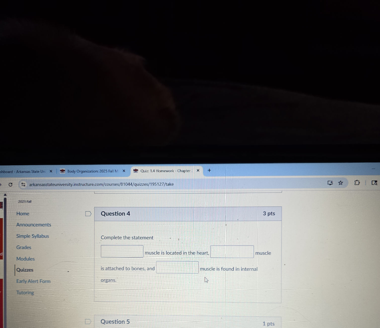 Complete the statement: [BLANK] muscle is | StudyX