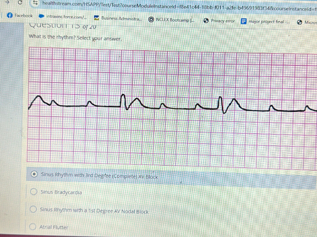 Question 15 of 20 What is the rhythm? Select | StudyX