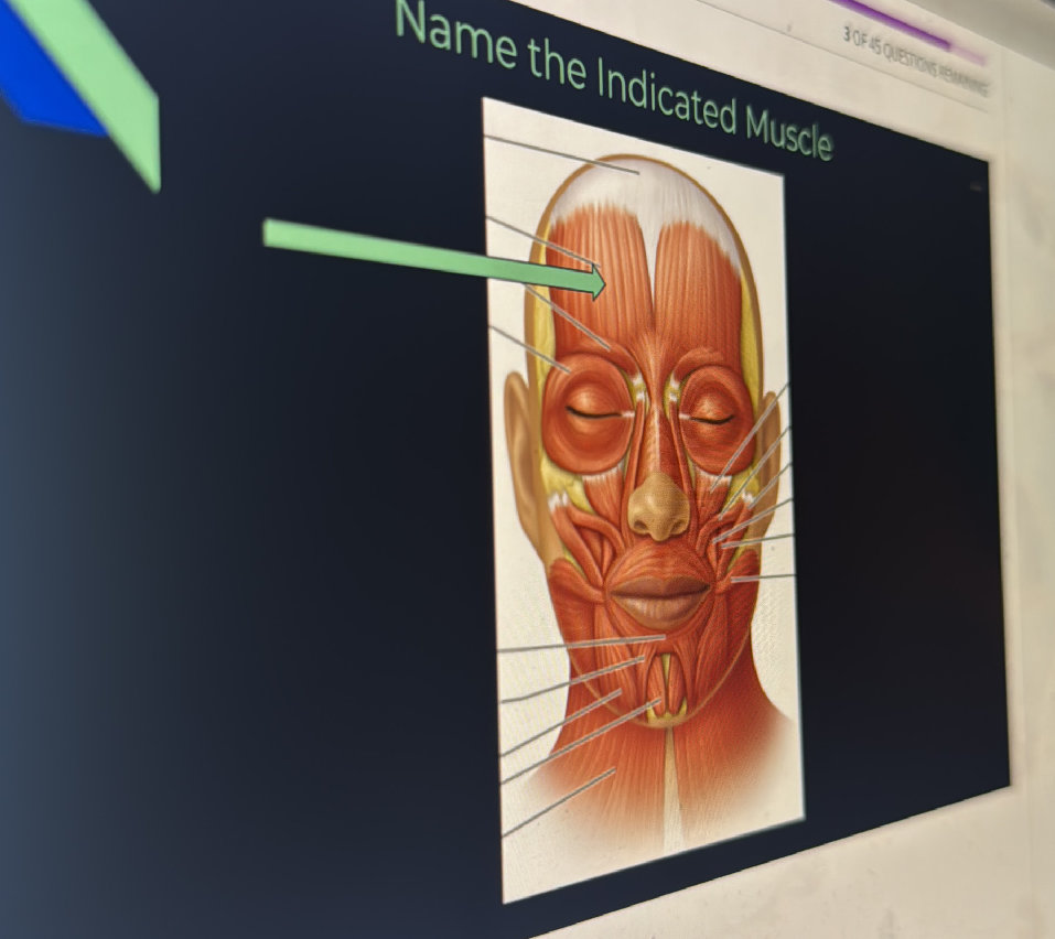 Name the Indicated Muscle (The image shows | StudyX