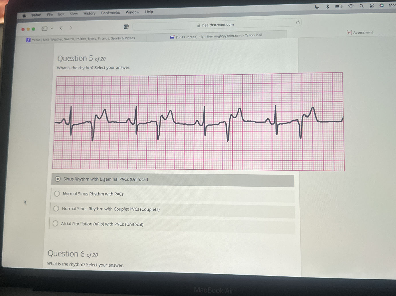 Question 5 of 20 What is the rhythm? Select | StudyX