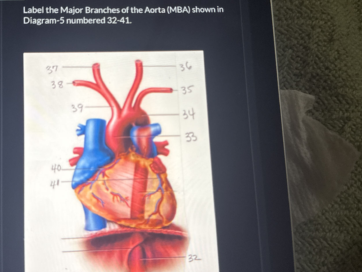 Label the Major Branches of the Aorta (MBA) | StudyX