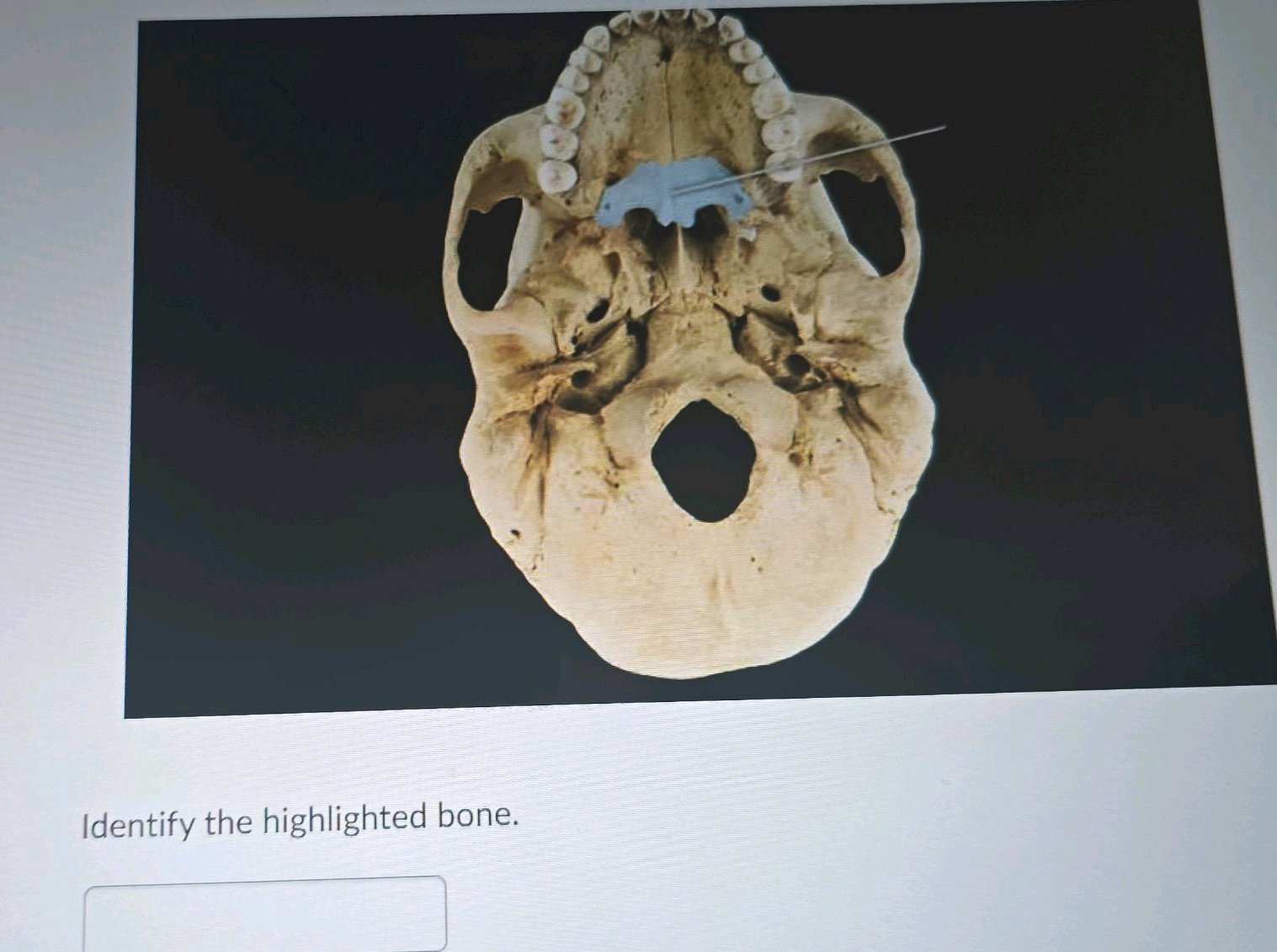 Identify the highlighted bone in the skull | StudyX