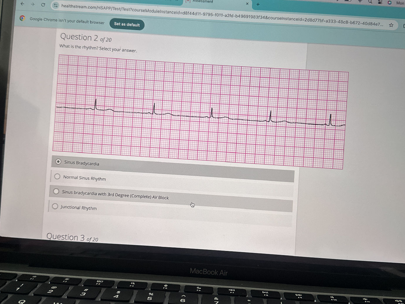 Question 2 of 20 What is the rhythm? Select | StudyX