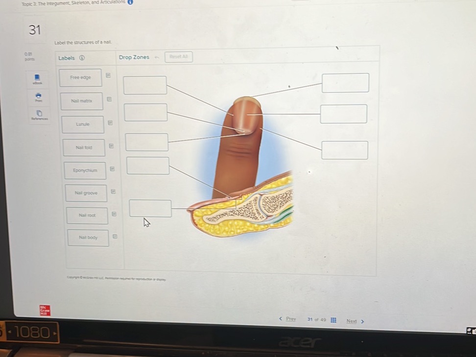 Label the structures of a nail. Labels | StudyX