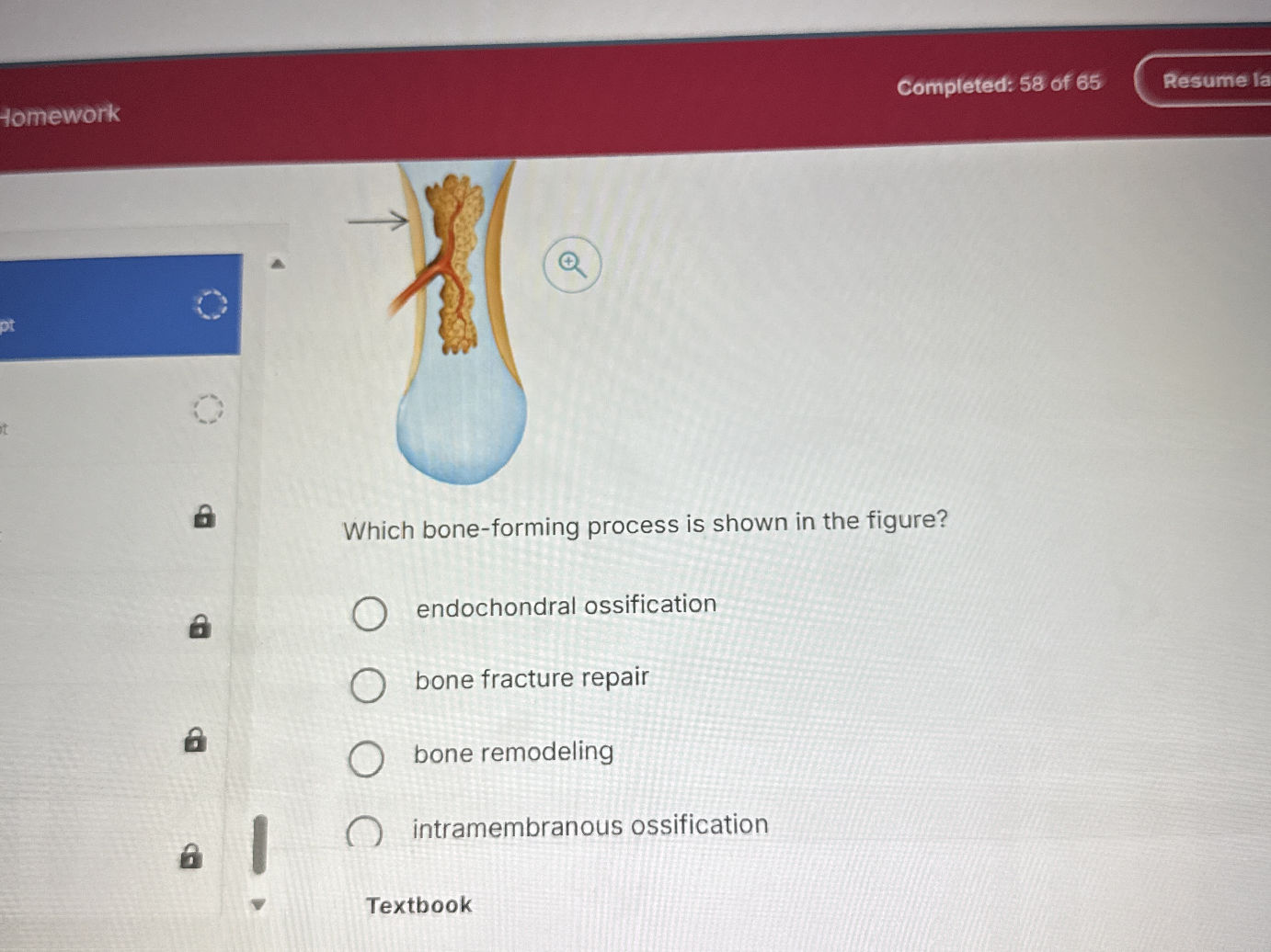 Which bone-forming process is shown in the | StudyX
