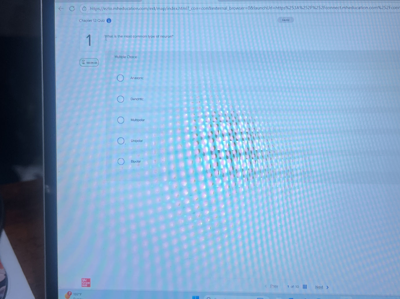 What is the most common type of neuron? | StudyX