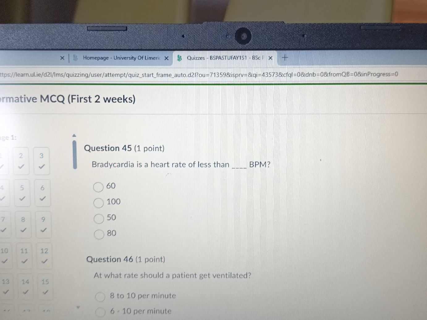 Question 45 (1 point) Bradycardia is a heart | StudyX
