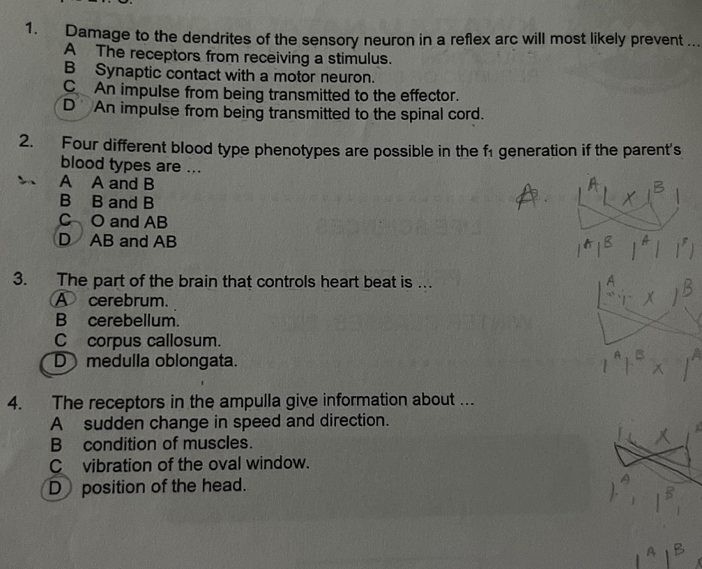 Damage to the dendrites of the sensory | StudyX