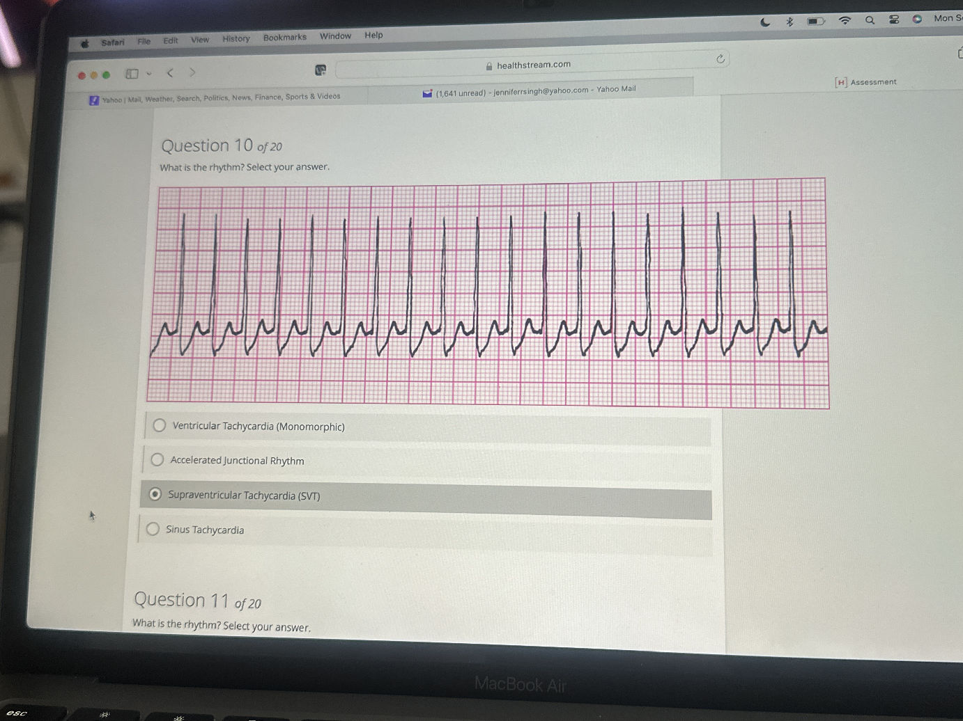 Question 10 of 20 What is the rhythm? Select | StudyX