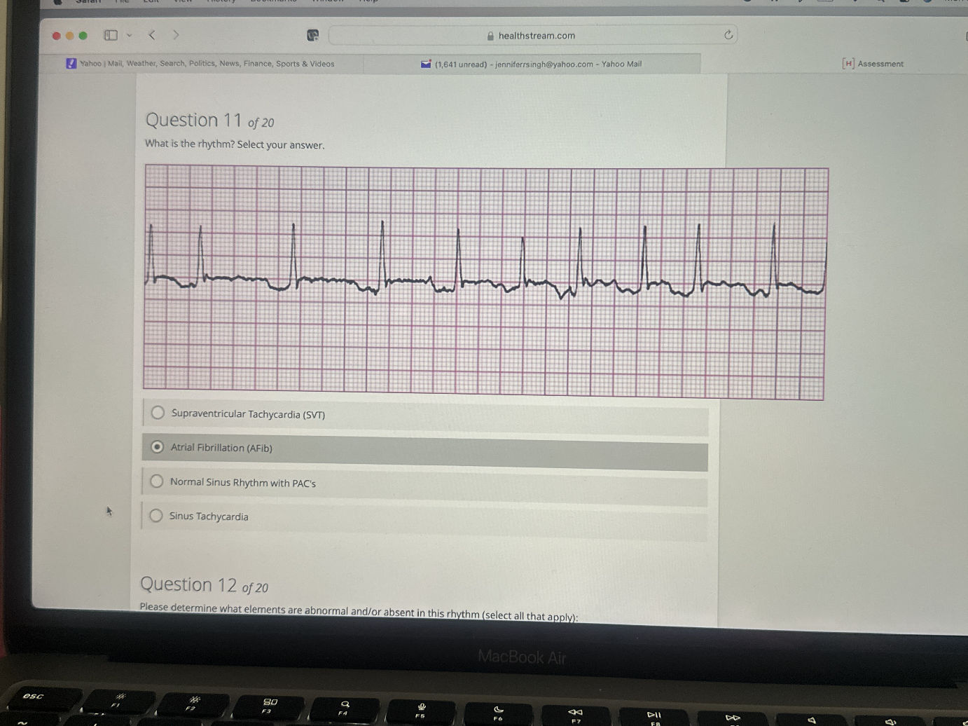 Question 11 of 20 What is the rhythm? Select | StudyX