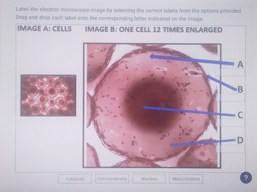 Label the electron microscope image by | StudyX