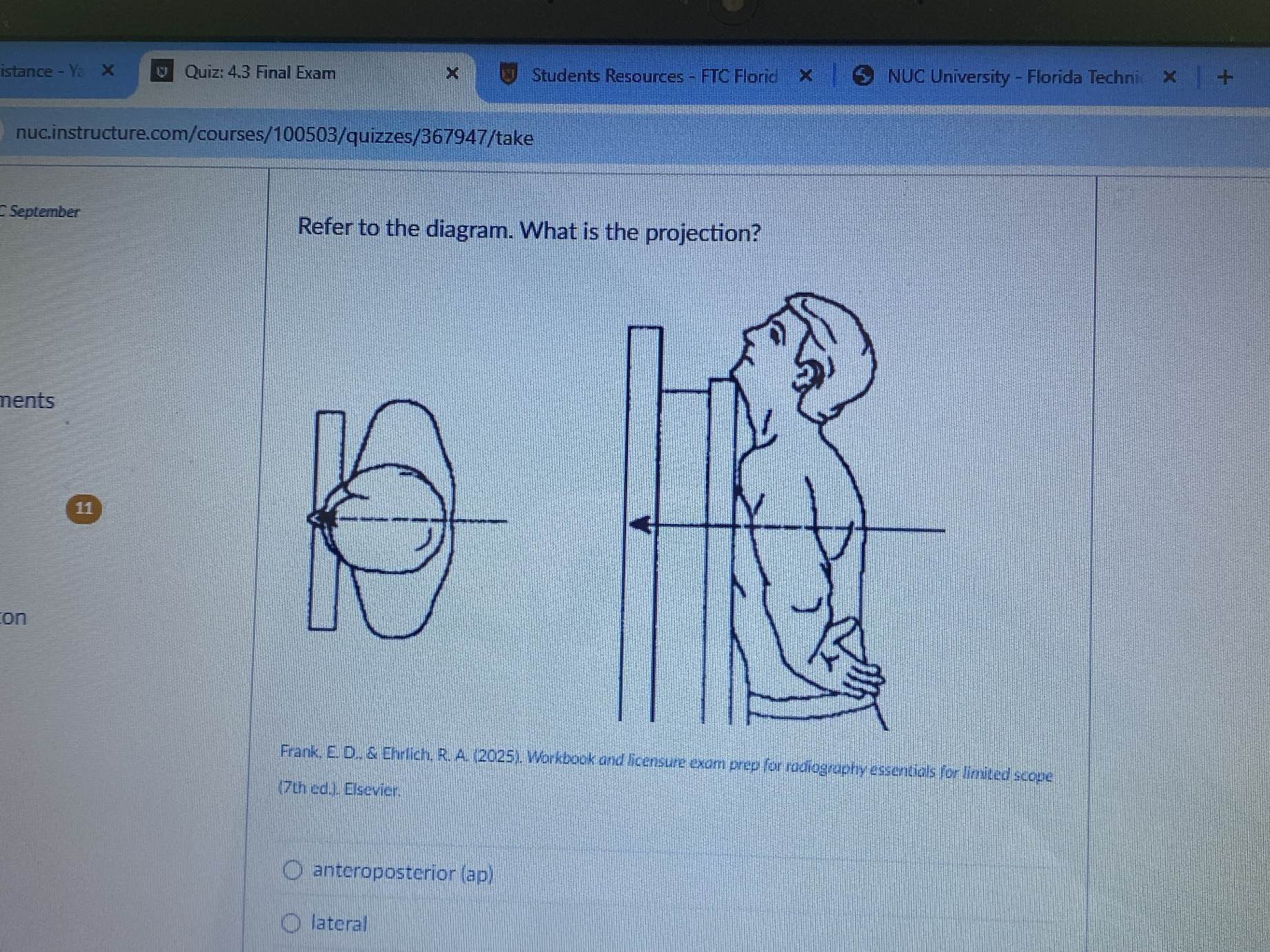 Refer to the diagram. What is the | StudyX